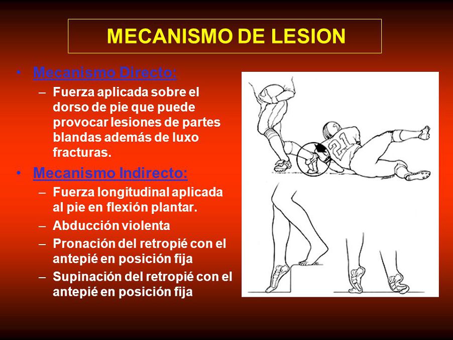 Lesiones Leves